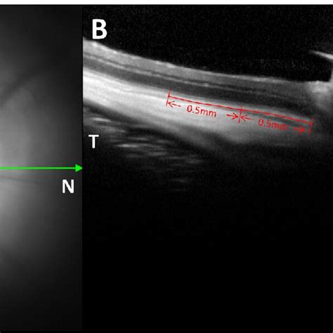 The Thickness Of Each Retinal Layer At Different Locations Measured Download Scientific Diagram