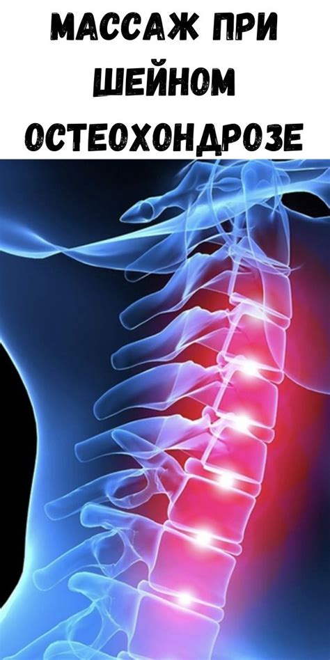 Массаж при шейном остеохондрозе Полезные советы красоты
