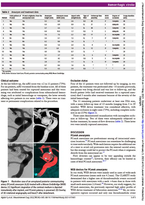Web Device For Treatment Of Posterior Communicating Artery Aneurysms Dr Guilherme Brasileiro