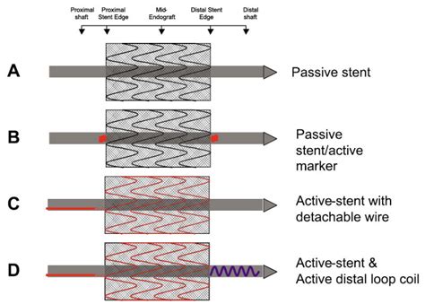 Real Time Magnetic Resonance Guided Endovascular Repair Of Experimental Abdominal Aortic
