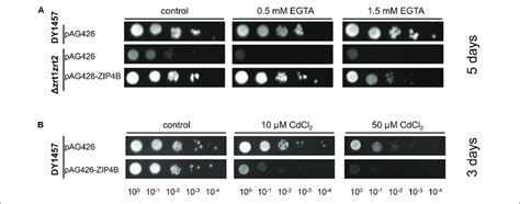 Complementation By Ntzip4b Cdna Of Yeast Mutants Defective In Metal Download Scientific