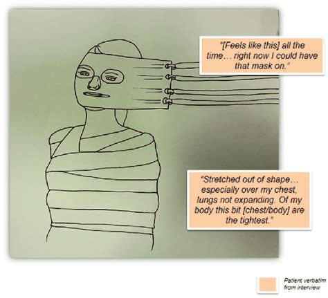 A Patient S Illustration Depicting Their Experience Of Skin Symptoms Of
