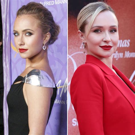 did hayden panettiere get plastic surgery then now photos