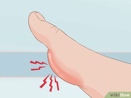 How To Treat A Swollen Toe Symptoms Causes Treatments