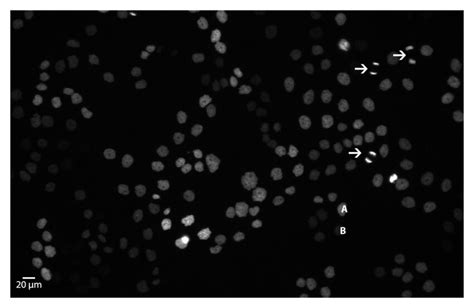 Representative Frame Of Fluo N2dl Hela Videos The Image Shows Some Of