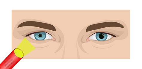 Pupil Test Eye Patient