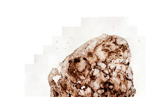 Image Artifacts In Mrxs Slide From 3dhistech Dx Software · Issue 432 · Openslideopenslide · Github