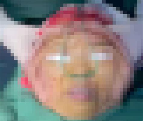 【閲覧注意】美容整形の裏側フェイスリフトで ”顔が外れる” 動画が拡散中 ポッカキットポッカキット