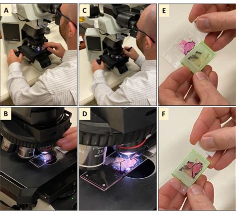 Enhancing Tumor Content Through Tumor Macrodissection