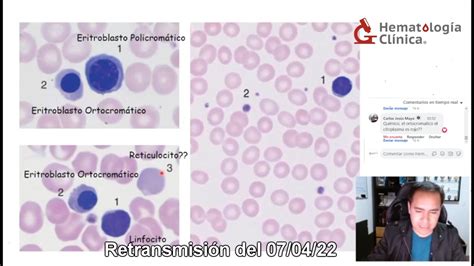 Eritropoyesis Por Si Te Perdiste Nuestra Transmision De Eritropoyesis Te Traemos La