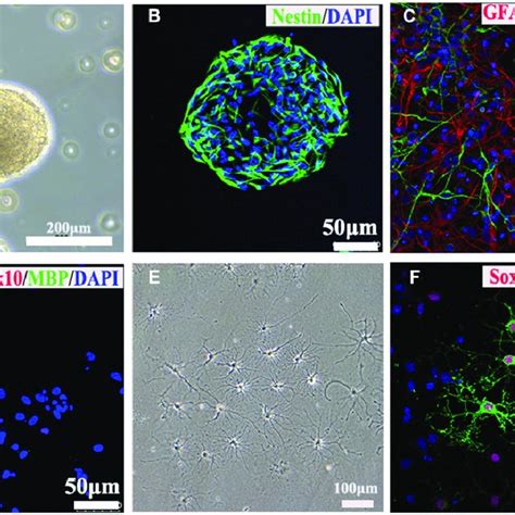 Three Dimensional Bioprinting Scaffold With Nscs And Olgs Promoted