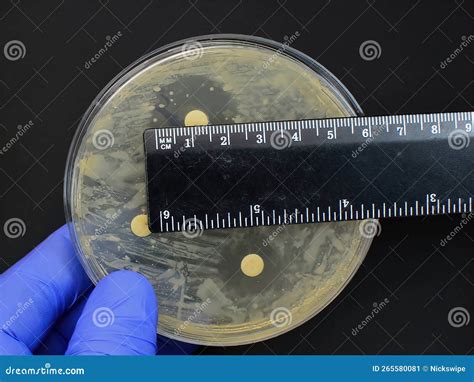 Antimicrobial Antibiotic Resistance Disc Test Interpretation Measuring