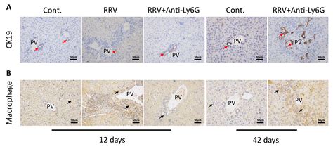 A Mouse Model Of Chronic Liver Fibrosis For The Study Of Biliary Atresia