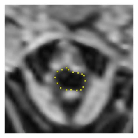 Four Examples Of Vocal Tract Cross Sections At Different Levels A