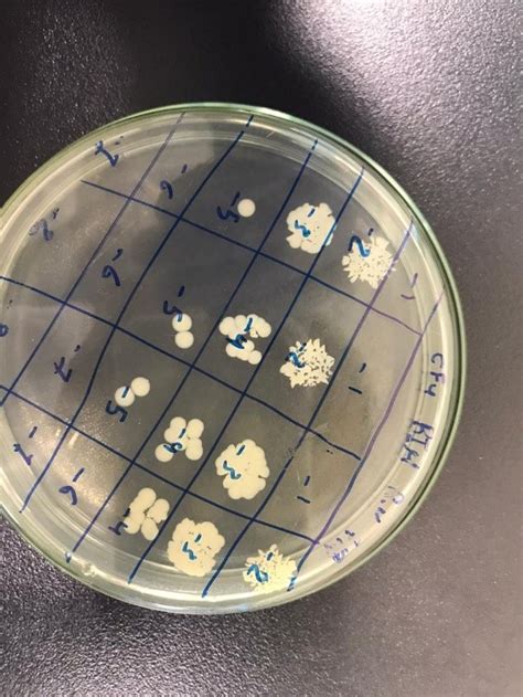 Is It Temprate Phage Why The Bacteria Does Not Grow In The First 10 Fold Dilution After