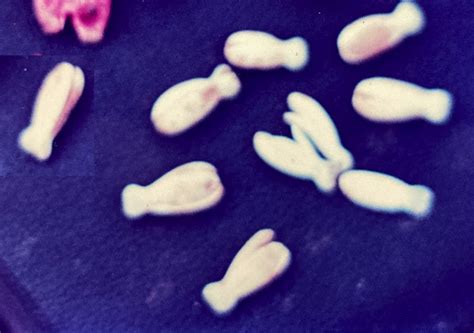 Xylopia Frutescens Trees Of Costa Ricas Pacific Slope