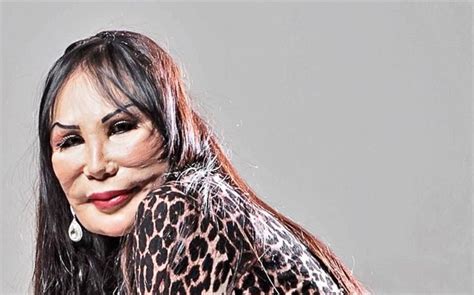 Lyn May Reaparece Con ‘nuevo Rostro Y Fans Aplauden Su Cambio Fama