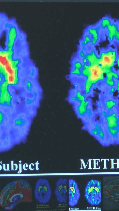 Methamphetamine Effects On Brain Methamphetamine Effects On Brain