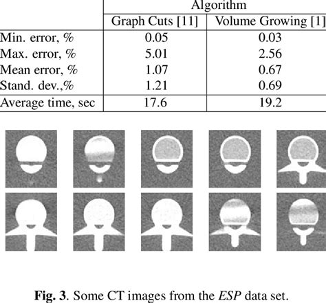 Accuracy Of Segmentation Of Trabecular Regions On 16 Data Sets Average