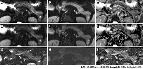Deep Learning Based Magnetic Resonance Imaging Reconstruction For