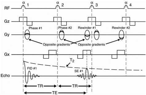 Gradient Echo Part Ii Fast Scanning Techniques Radiology Key