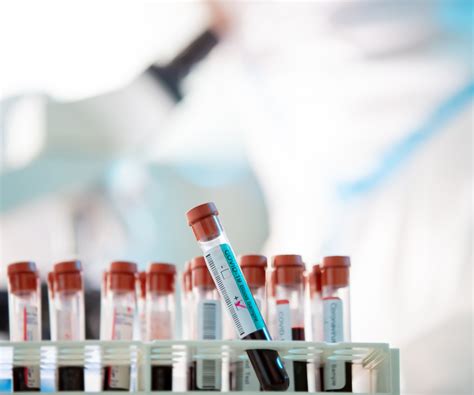 Top 10 Most Common Blood Tests Explained Path 24 Laboratories