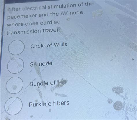 Solved A ﻿fter Electrical Stimulation Of The Pacemaker And