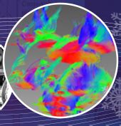 Multimodality Neurological Data Visualization With Multi VOI Based DTI Fiber Dynamic Integration