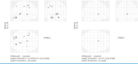 Regression Analysis Word Generationword Repetition Contrast Images Download Scientific