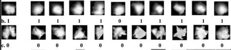 it s chest day uses of deep learning in chest abnormality detection