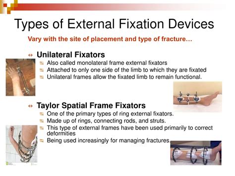 External Fixation Device Types And Definitions