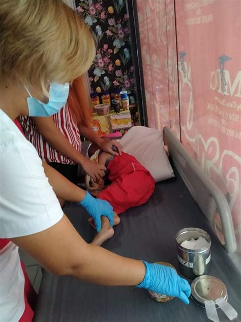 Erig Immunoglobulin Given With Tetanus Toxoid And Anti Rabies Mmdc Marilao Medical