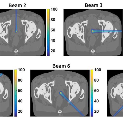Dose Distributions For The Seven Proton Pencil Beams Considered In This