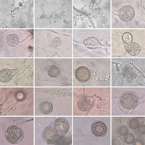 Pdf Two New Pythium Species From China Based On The Morphology And