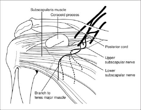 Infrascapular Nerve Medizzy