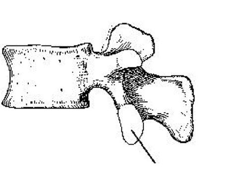 Ch Lumbar Spine Flashcards Quizlet
