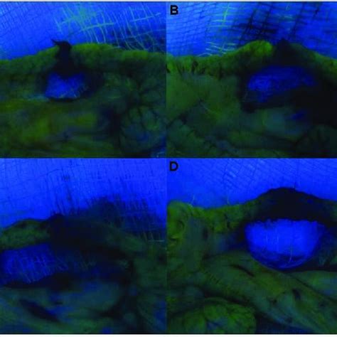 Fluorescein Fluorescence Patterns A Homogeneous B Reticular C