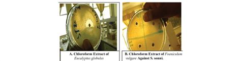 Zone Of Inhibition Chloroform Extract Of Eucalyptus Globules Against