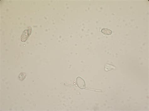 Phytophthora Cactorum Phytophthora Root Rot