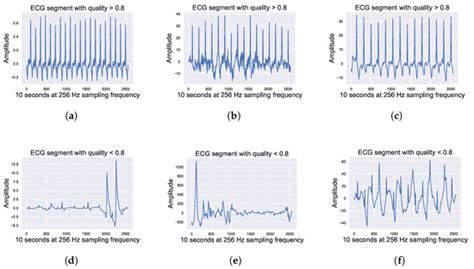 Sensors Special Issue Ecg Signal Processing Techniques And Applications
