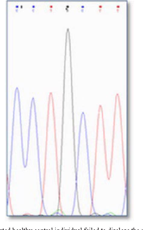 Figure 2 From A Novel Missense Mutation In Exon 7 Of The Ecm1 Gene In An Iranian Lipoid