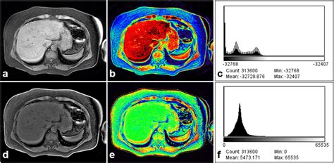 An Example Showing The Bias Correction Of Signal Inhomogeneity Based On Download Scientific