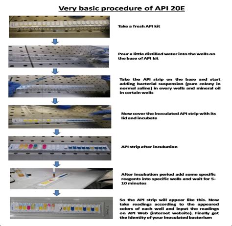 7 Basic Procedure Of Api 20e Download Scientific Diagram