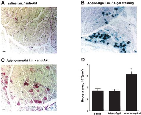 Intramuscular Transfection Of Adeno Myrakt Is Suf Fi Cient To Induce