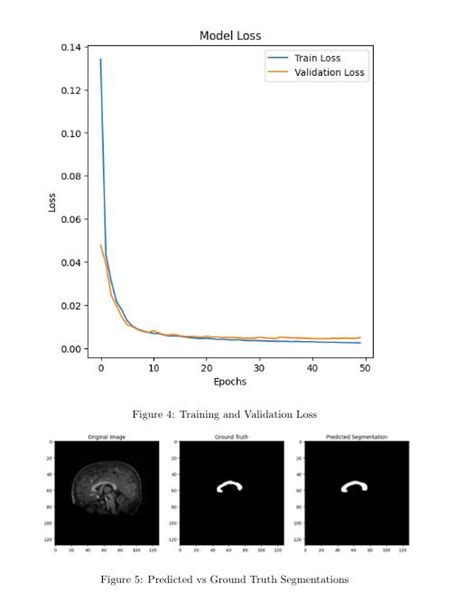computervision deeplearning medicalai segmentation optimization… mohamed iyed tahri