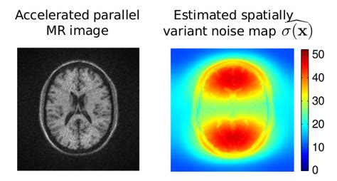 Spatially Variant Noise Estimation In Mri Ieee Transactions On Pattern Analysis And Machine