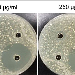 Growth Inhibitory Zone Of Surfactin Against B Hyodysenteriae Using