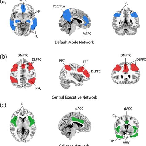 Aberrant Functional Connectivity Between Three Networks 1 Download Scientific Diagram