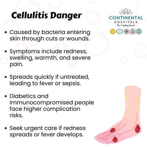 Cellulitis When Does A Skin Infection Turn Serious