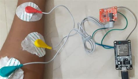 IoT Based ECG Monitoring With AD8232 ECG Sensor ESP32